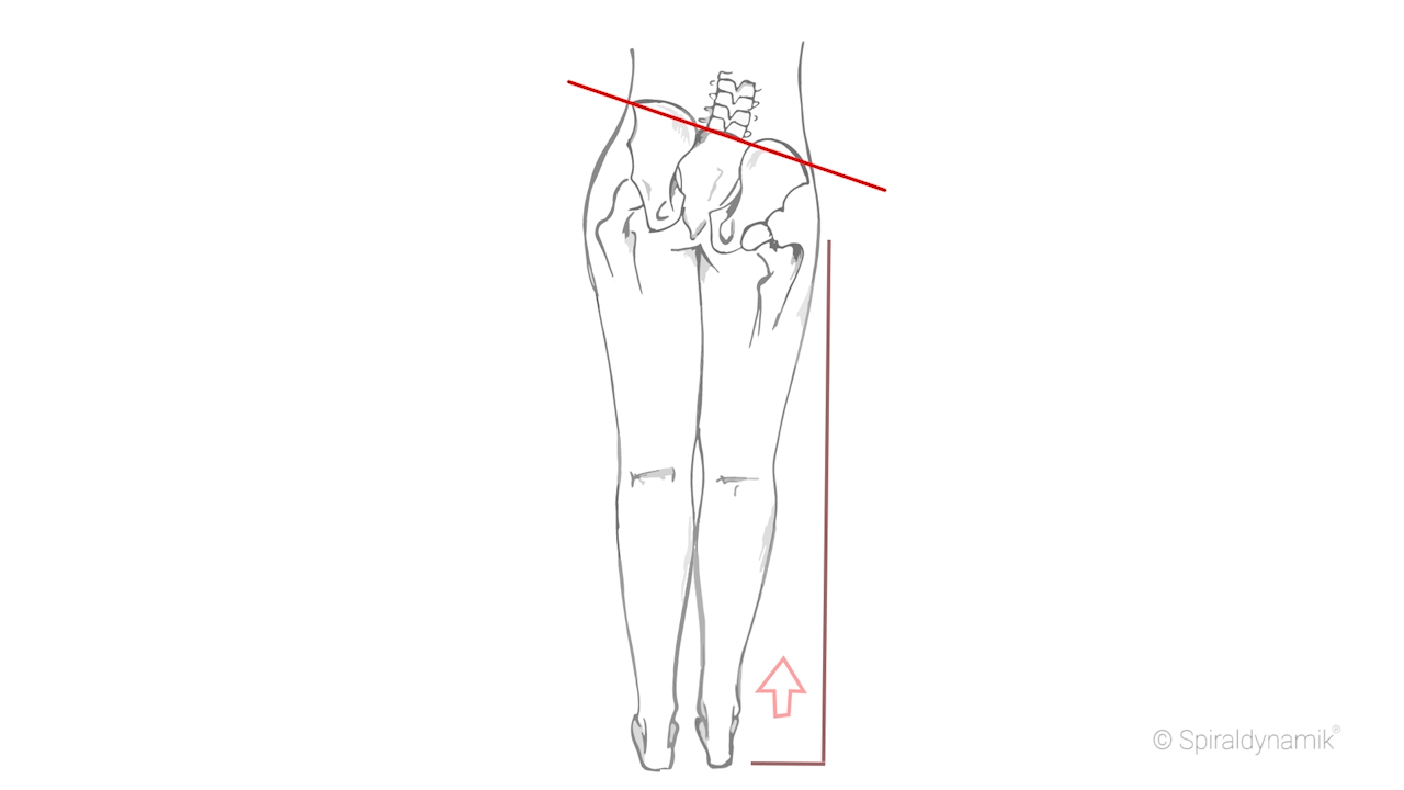 Therapie Beckenschiefstand